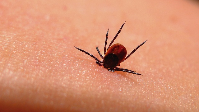 Lyme Disease: Tick Bites Might Seem Harmless But One Women Tells Of ...