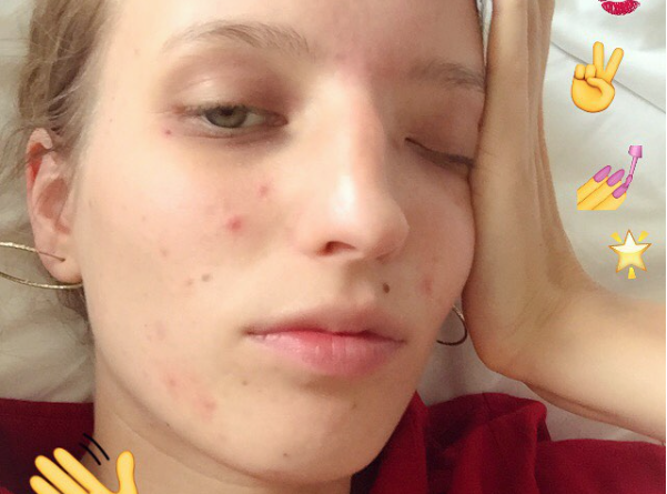 Pimples, Body Hair & Stretch Marks: Meet The Photographer Shunning ...