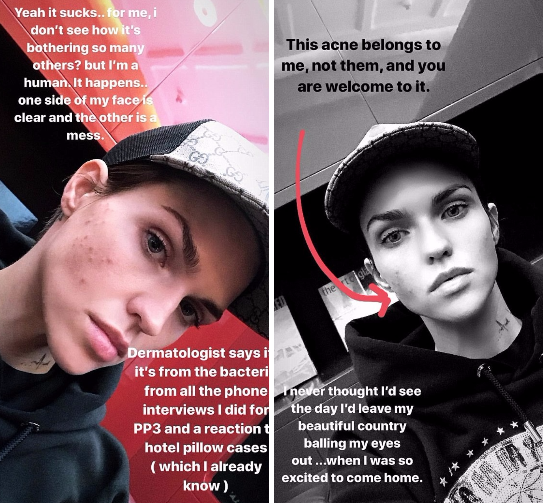 "Bawling My Eyes Out": Ruby Rose Reveals Surprising Struggle With Adult ...
