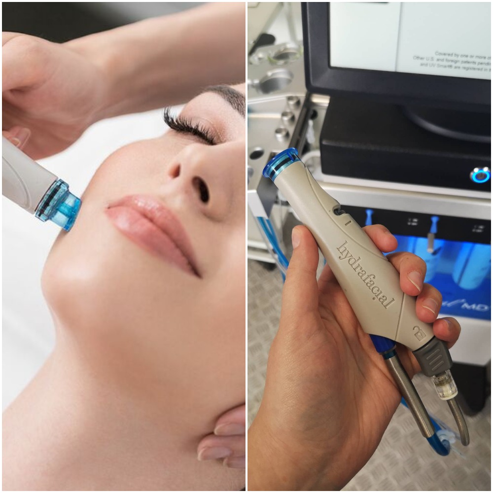 I Had A HydraFacial, And Here's All The Gunk That Was Hoovered Out Of ...